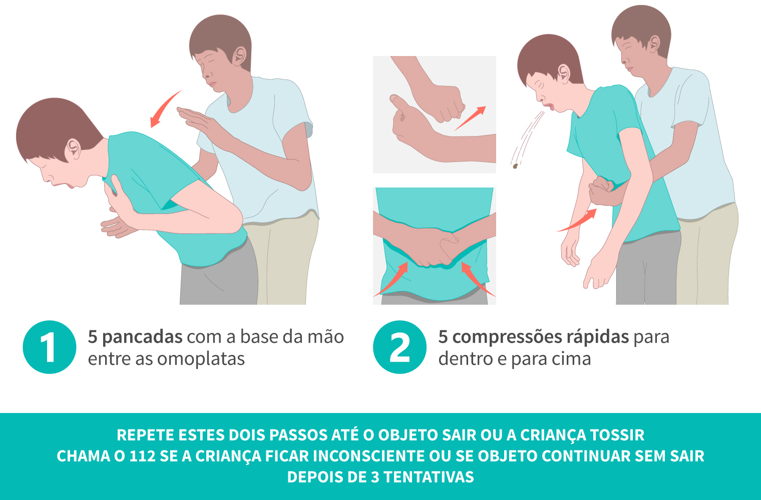 Engasgo: como reagir em bebés e crianças | Dra. Cegonha